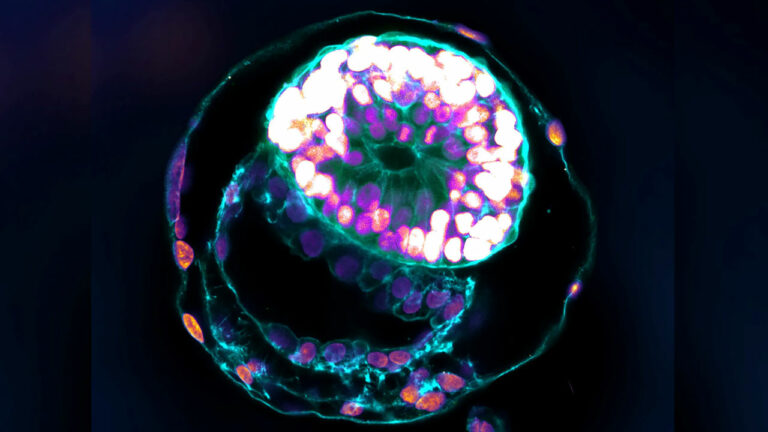 Human Embryo | వీర్యం, అండం లేకుండానే పిండాన్ని సృష్టించిన ఇజ్రాయెల్ ...