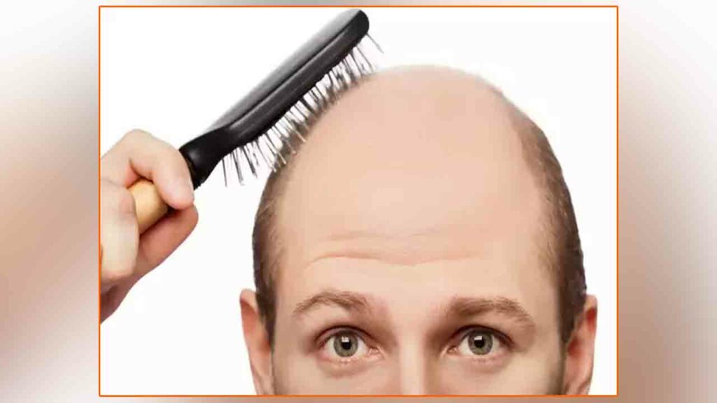 Bald Hair | బట్టతల మగవారికే ఎందుకొస్తుంది ? ఆడవారికి రాదెందుకు ...